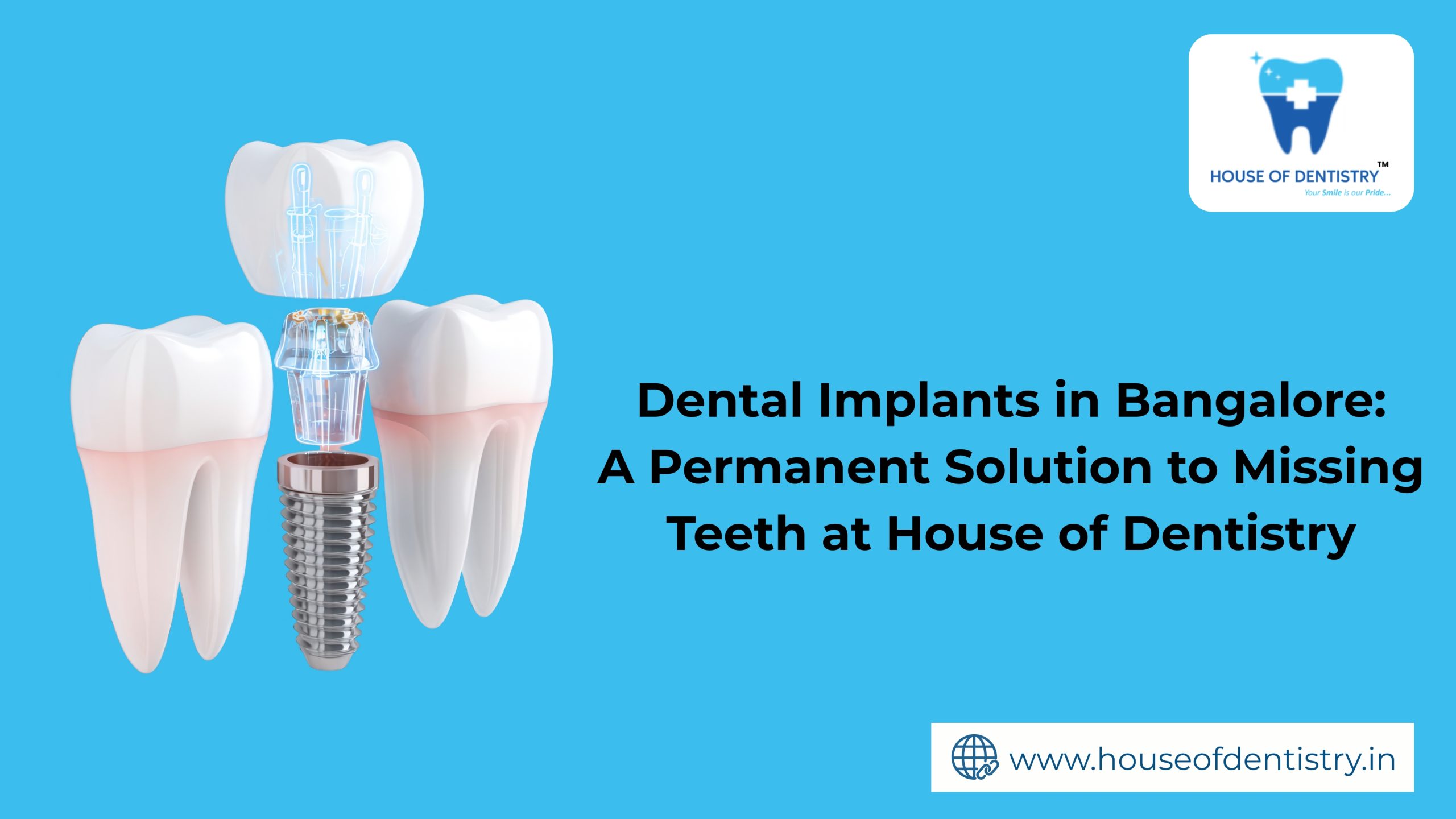 Dental Implants in Bangalore | Permanent Tooth Replacement at House of Dentistry